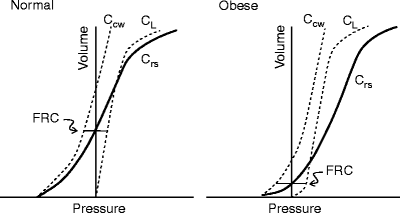 Effects of Obesity on Lung Function | SpringerLink