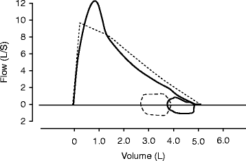 Effects of Obesity on Lung Function | SpringerLink