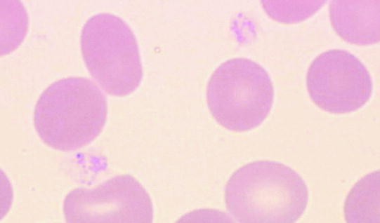 Platelet Morphology Analysis | SpringerLink