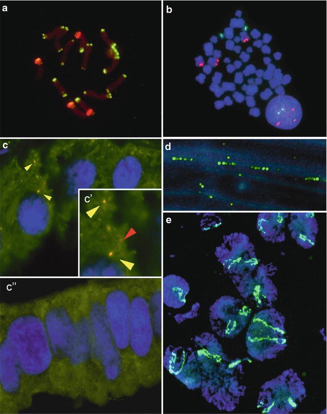 FISH Methods in Cytogenetic Studies | SpringerLink