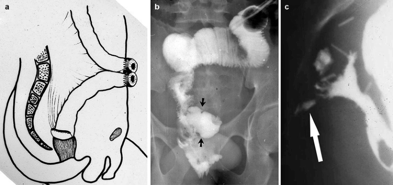 Defecography | SpringerLink