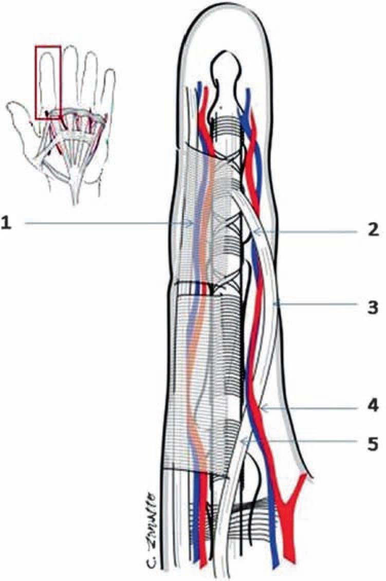 Acquired Diseases of the Hand (Rheumatoid Arthritis and Dupuytren's ...