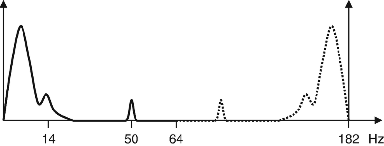 EEG Signal Acquisition | SpringerLink