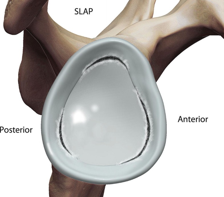 Clinical Anatomy and Biomechanics of the Sporting Shoulder | SpringerLink