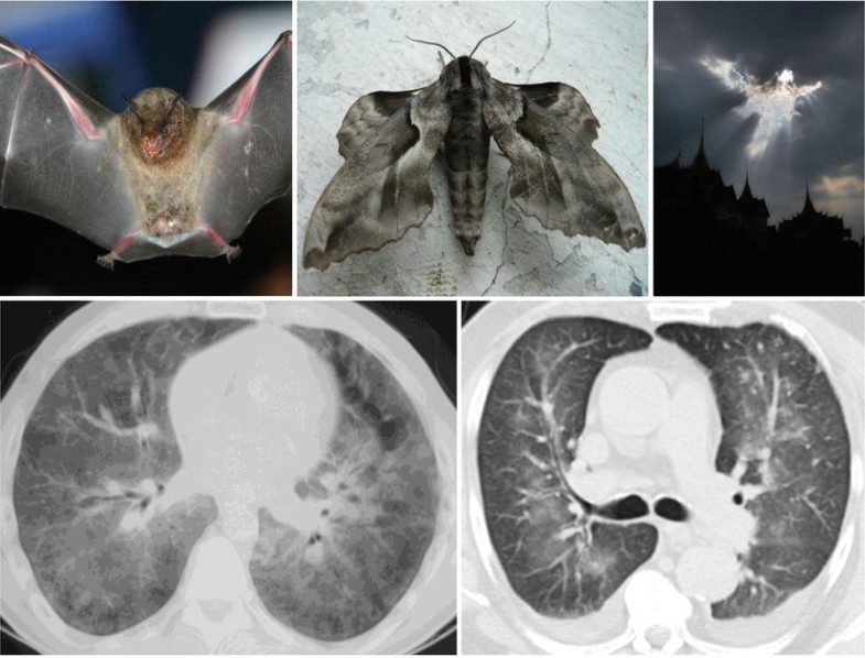 Bat Wing, Butterfly, or Angel Wing Sign | SpringerLink