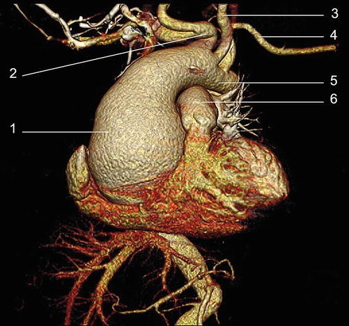 Thoracic Angiography | SpringerLink