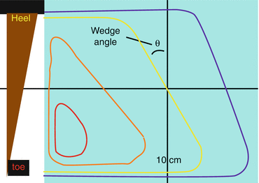 Characteristics of Photon Beams | SpringerLink
