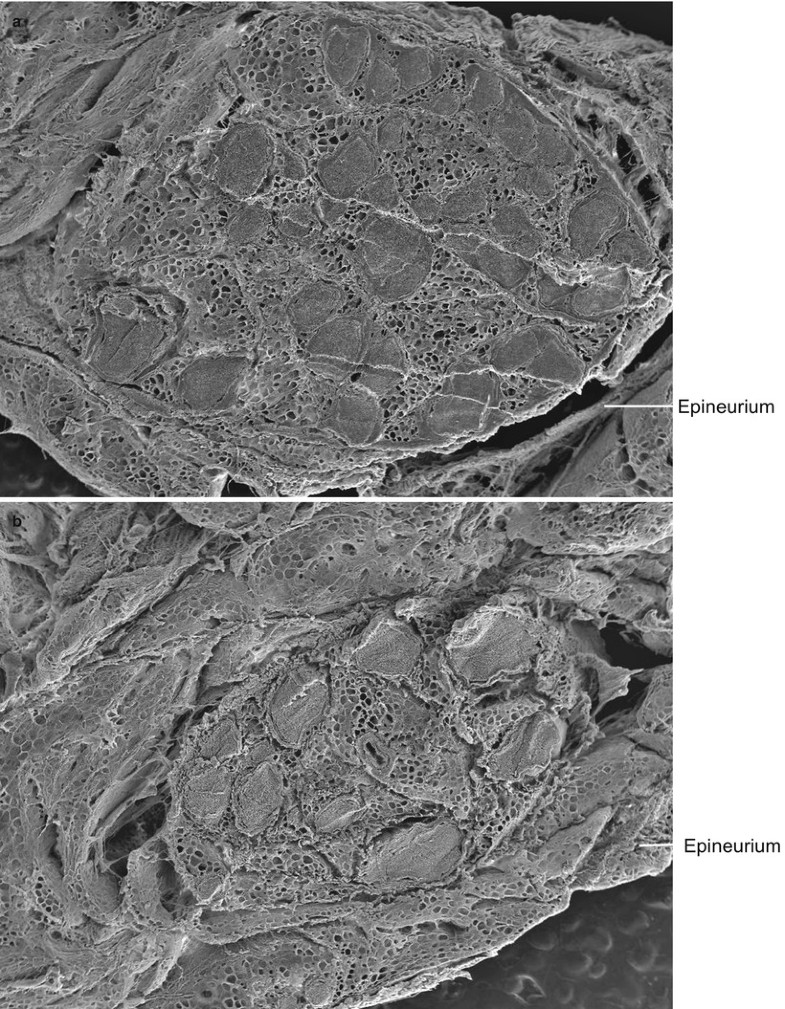 Ultrastructure of the Epineurium | SpringerLink
