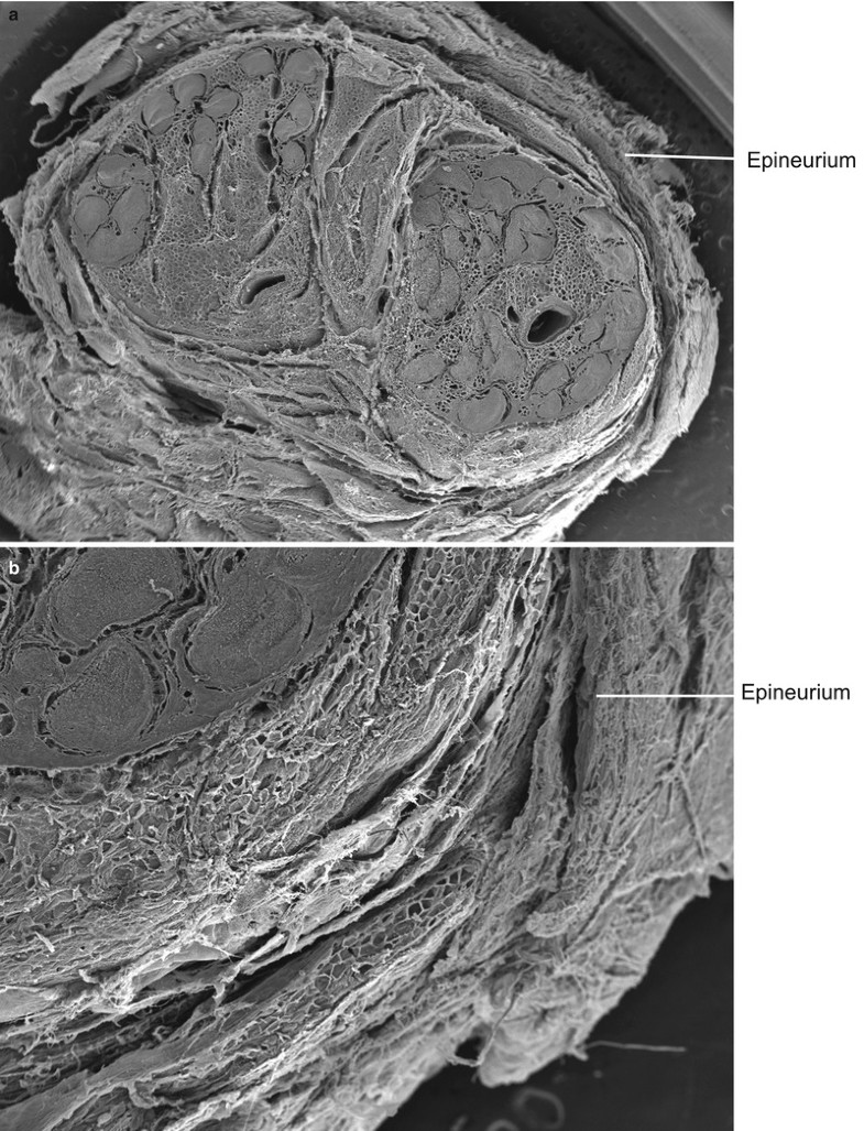 Ultrastructure of the Epineurium | SpringerLink