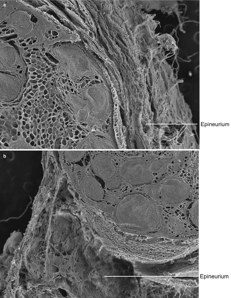 Ultrastructure of the Epineurium | SpringerLink