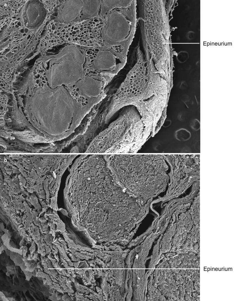 Ultrastructure of the Epineurium | SpringerLink