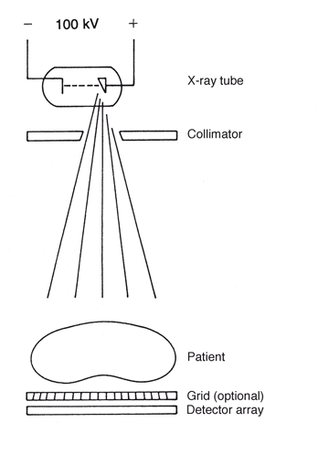 Medical Uses of X-Rays | SpringerLink