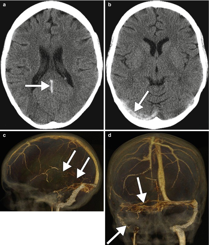Iodinated Contrast Agents | SpringerLink
