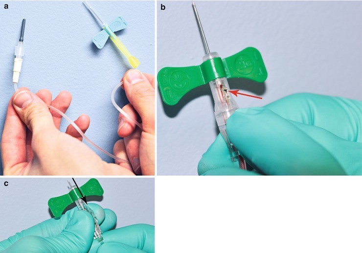 Venipuncture | SpringerLink