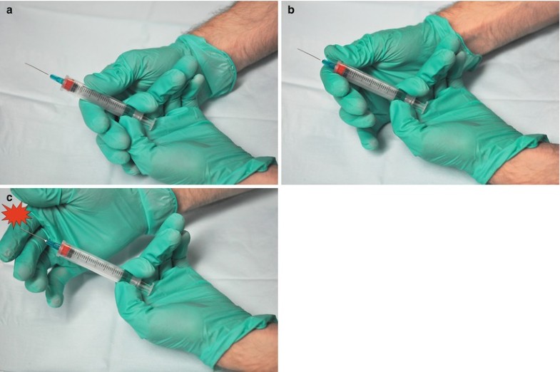 Injections | SpringerLink