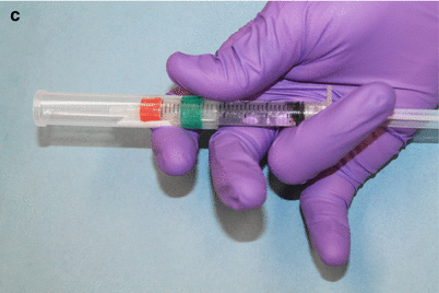 Injections | SpringerLink