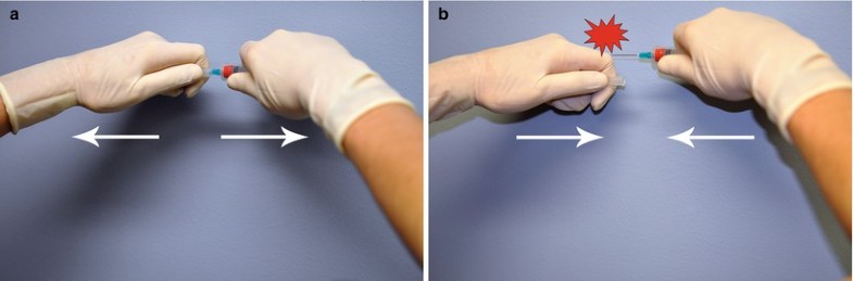 Injections | SpringerLink