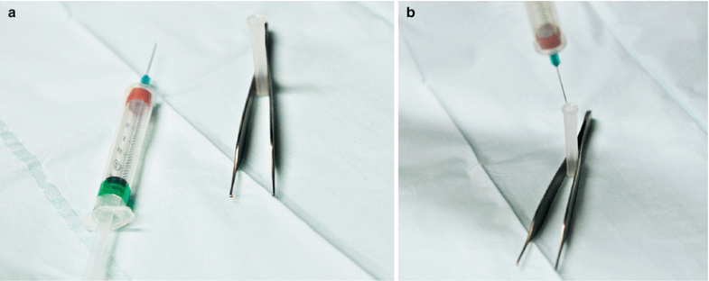 Injections | SpringerLink