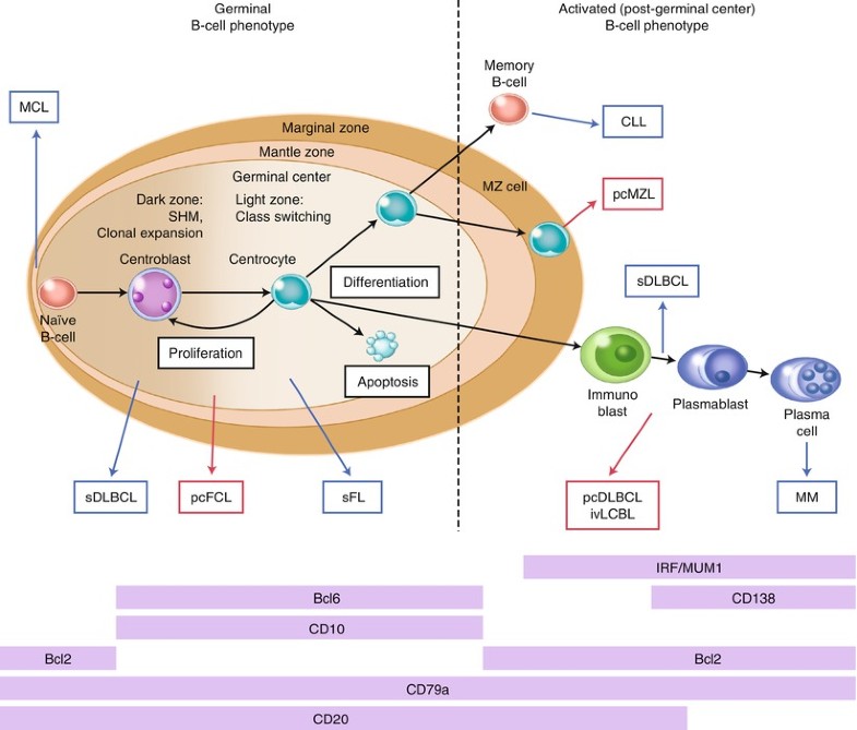 Introduction to the B-Cell Lymphomas | SpringerLink