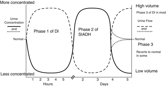 The Posterior Pituitary Gland and Disorders of Vasopressin Metabolism ...