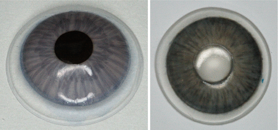 Scleral Shell Prostheses and Prosthetic Contact Lenses | SpringerLink