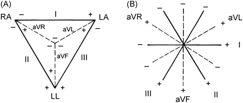 Basic ECG Theory, 12-Lead Recordings, and Their Interpretation ...