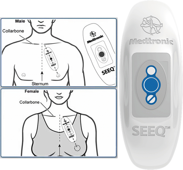 Basic ECG Theory, 12-Lead Recordings, and Their Interpretation ...