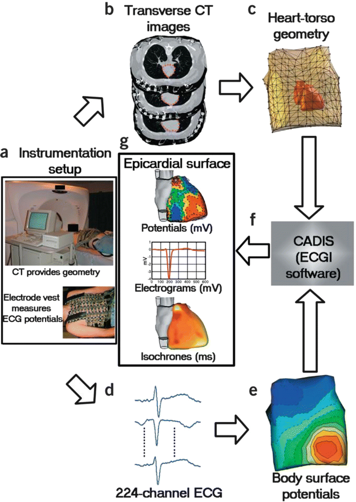 Cardiac Mapping Technology | SpringerLink