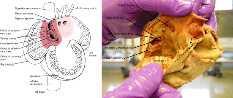 Anatomy of the Human Heart | SpringerLink