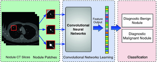 Multi-scale Convolutional Neural Networks for Lung Nodule Classification | SpringerLink