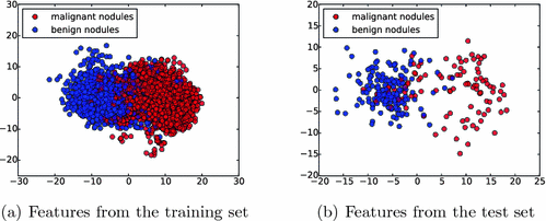 Multi-scale Convolutional Neural Networks for Lung Nodule Classification | SpringerLink