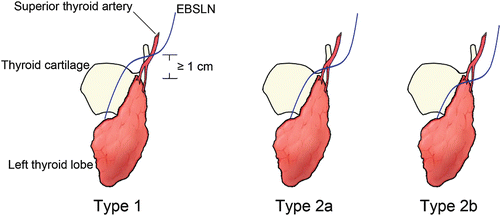Intraoperative Neuro-monitoring of the Laryngeal Nerves During Thyroidectomy | SpringerLink
