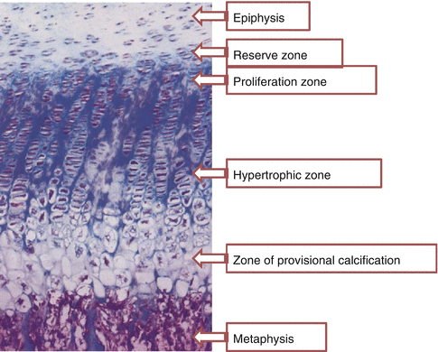 Growth Plate | SpringerLink