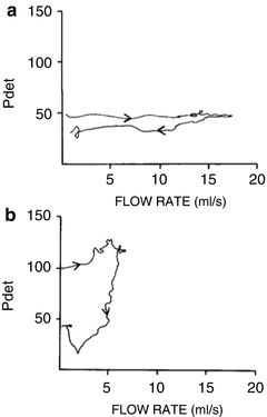 Nomograms | SpringerLink