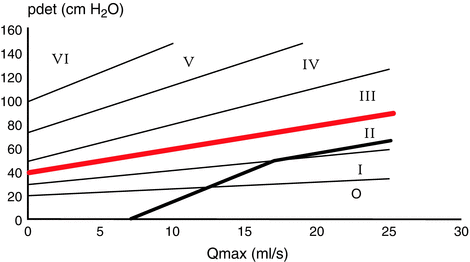 Nomograms | SpringerLink