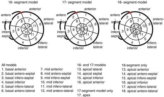 Standardized Myocardial Segmentation of the Left Ventricle | SpringerLink