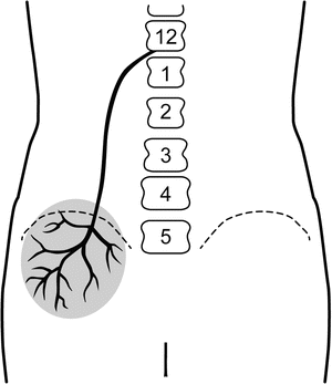 Thoracolumbar Syndrome | SpringerLink
