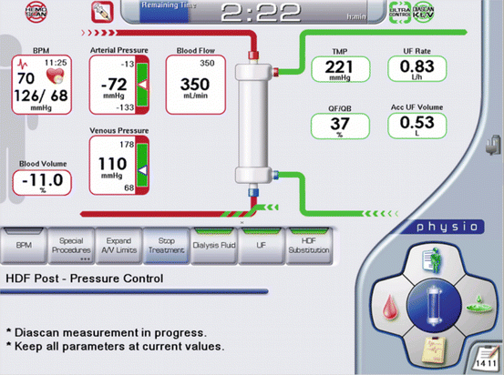 Baxter Online Hemodiafiltration Systems | SpringerLink