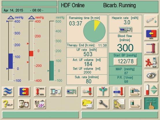 Dialog+: B. Braun Hemodiafiltration System | SpringerLink