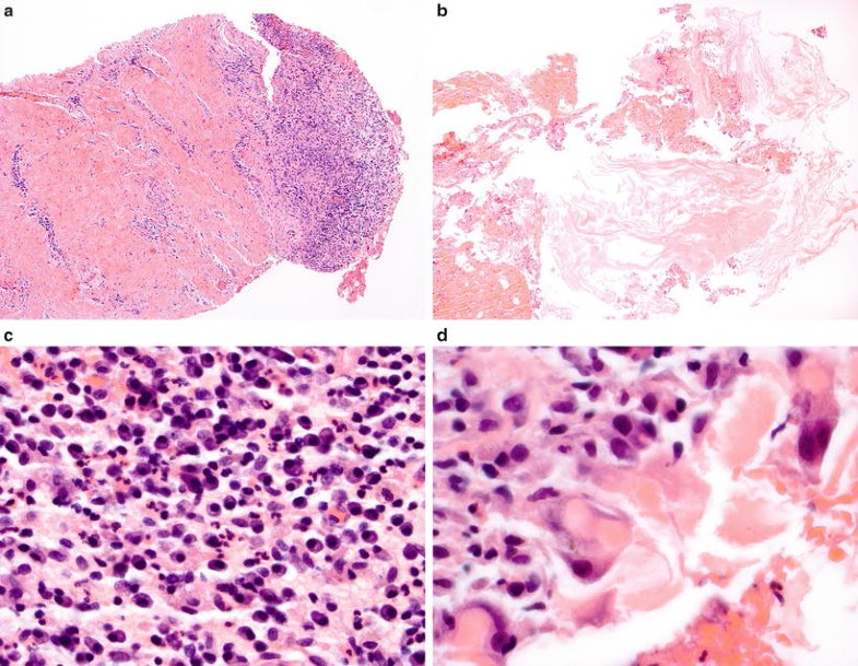 Lesions of the Nipple | SpringerLink