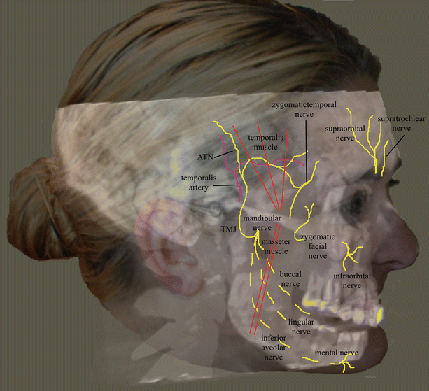 Supraorbital Nerve Entrapment: Face | SpringerLink