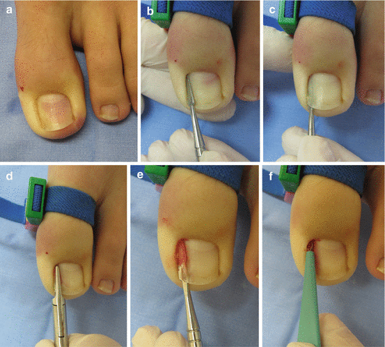 Surgical Treatment | SpringerLink