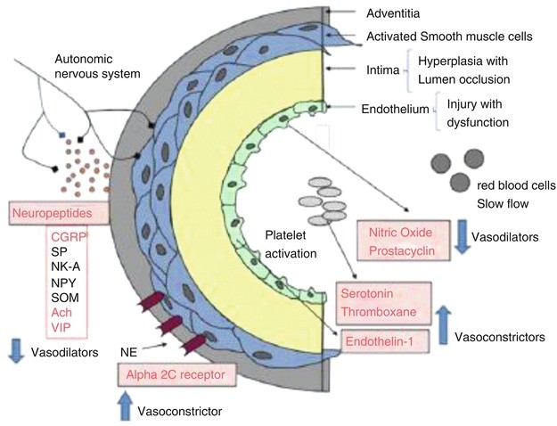 Raynaud’s Phenomenon, Digital Ulcers and Nailfold Capillaroscopy ...