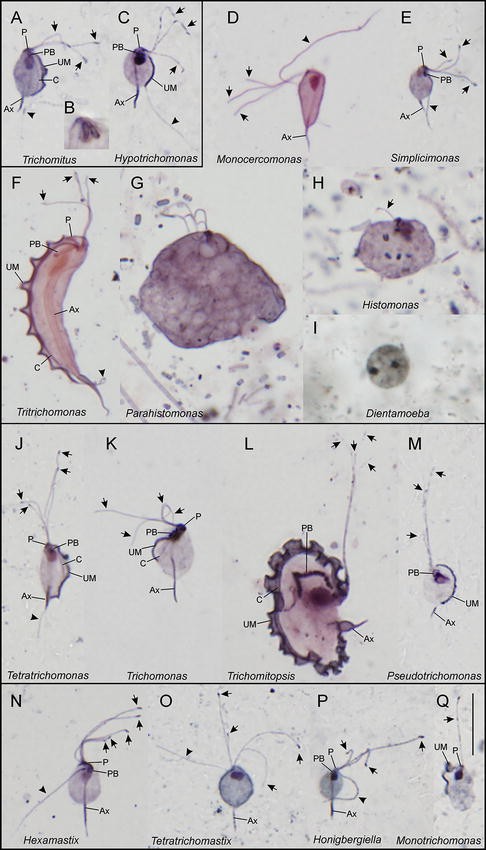 Parabasalia | SpringerLink