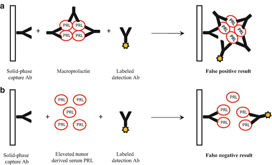 Physiopathology, Diagnosis, and Treatment of Hyperprolactinemia | SpringerLink
