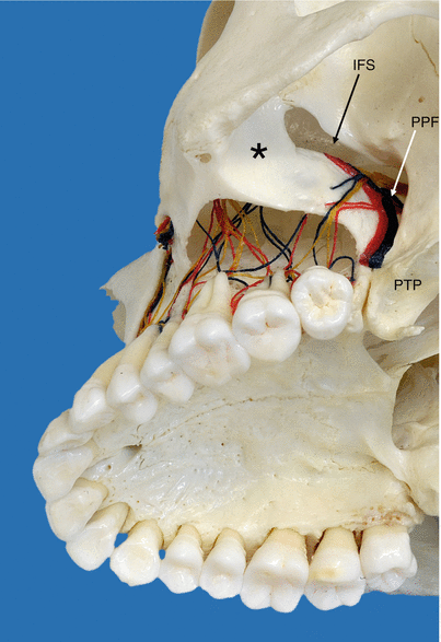 Posterior Maxilla | SpringerLink