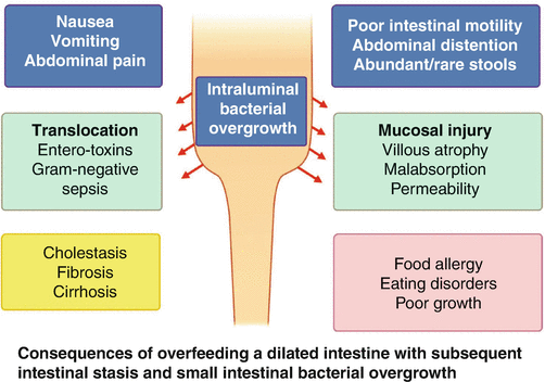 Intestinal Failure in Children | SpringerLink