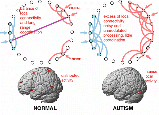 Autism Spectrum Disorders: Developmental History of a Concept ...