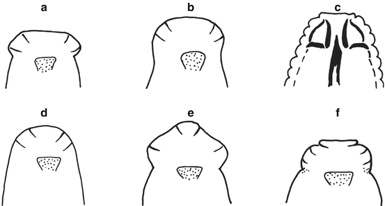 Nematode Morphology and Classification | SpringerLink
