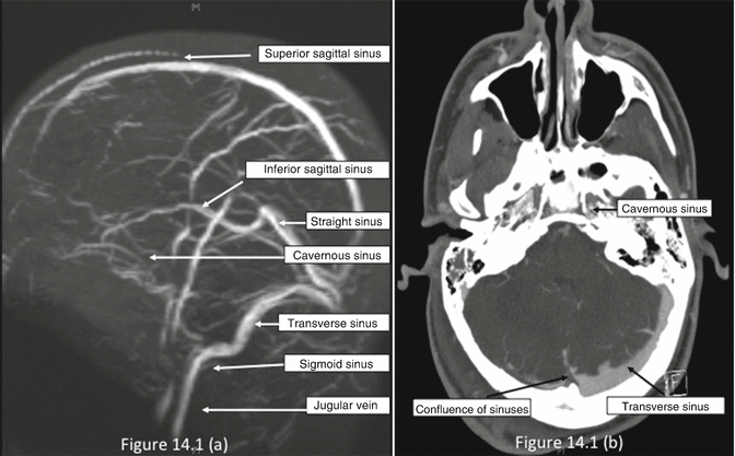 Monitoring of Jugular Venous Oxygen Saturation | SpringerLink
